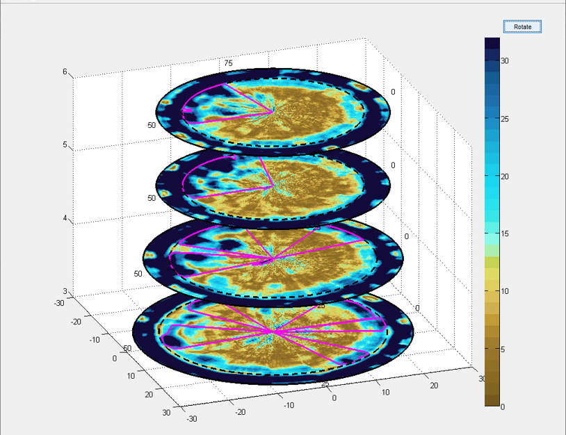 Tree Radar Mapping – Fulgham's Inc